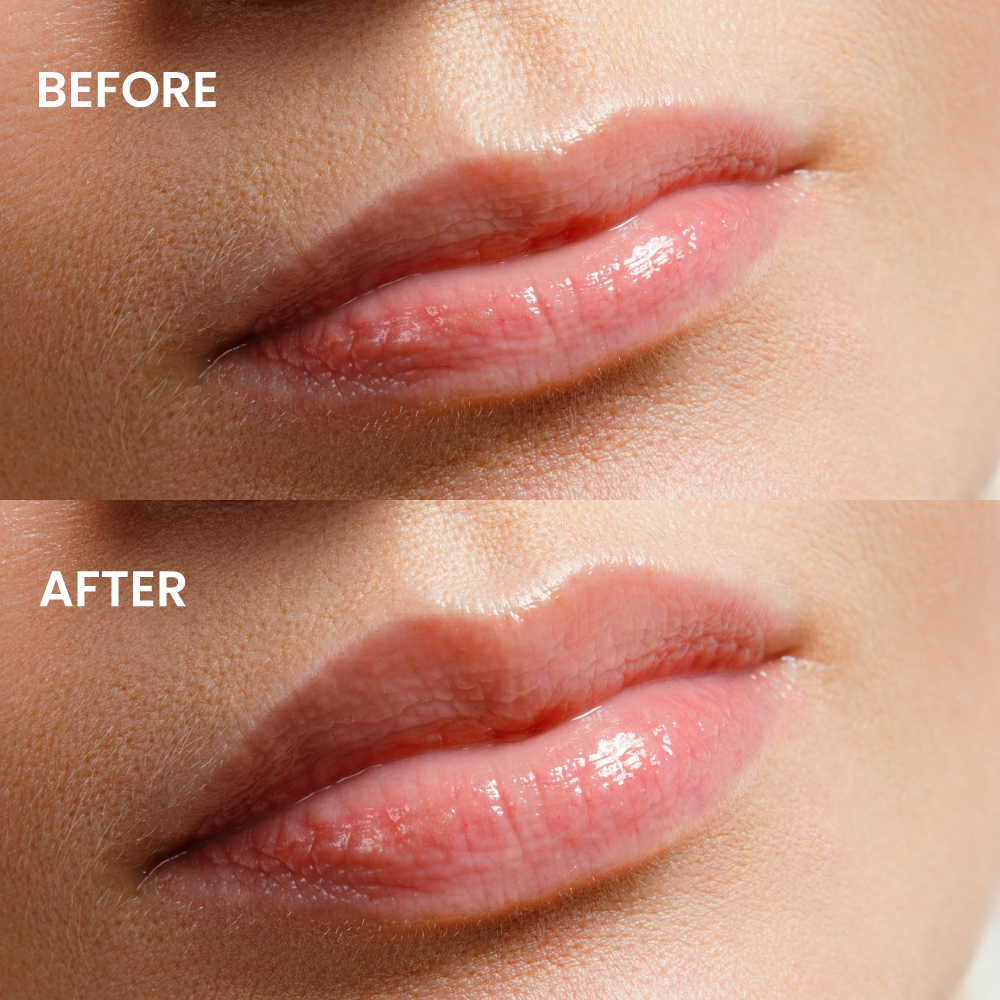 Hype Lip| Gloss rimpolpante e volumizzante